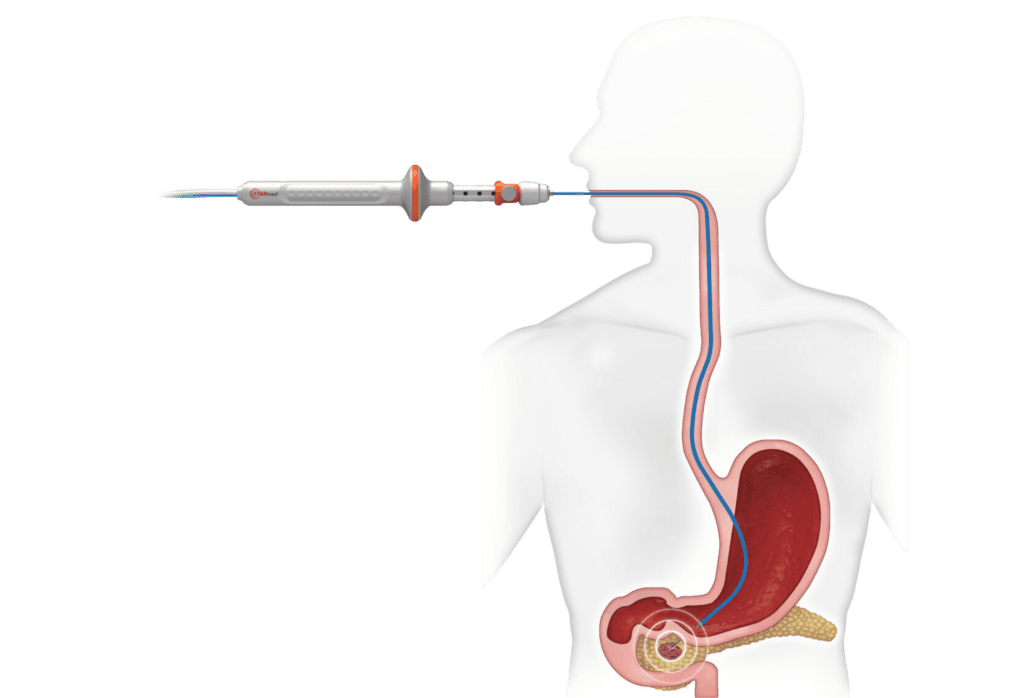 Endoscopic – STARmed America