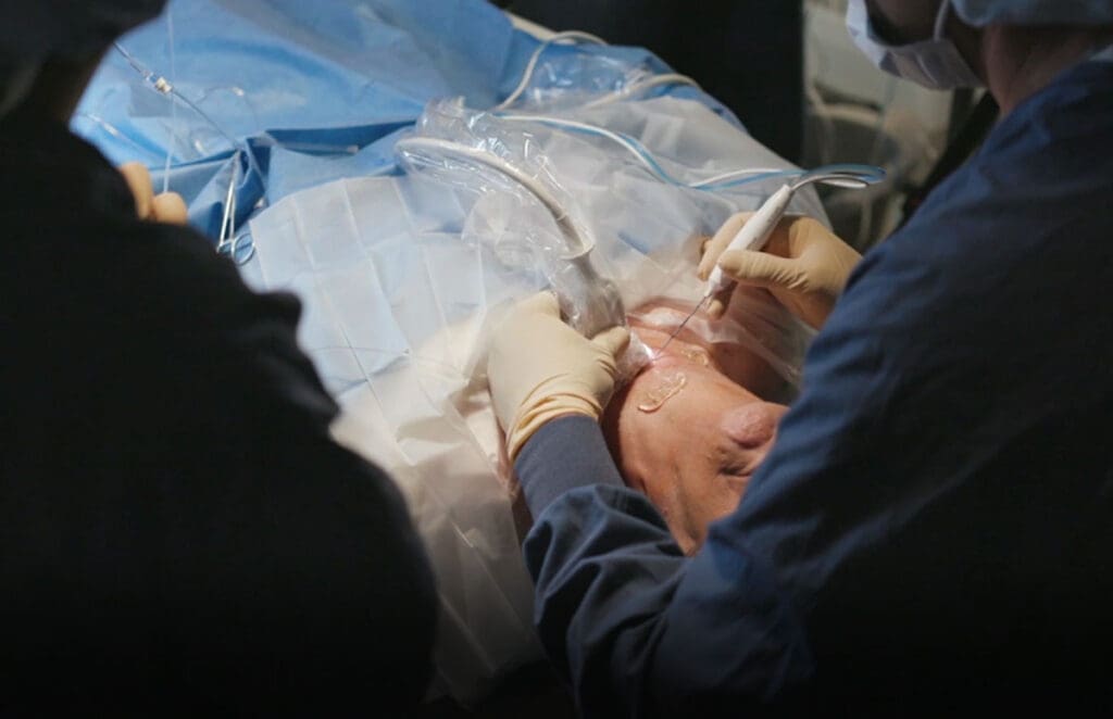 What is Thermal Ablation? | STARmed America